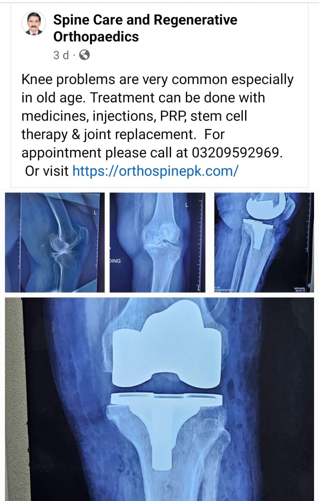 Knee Pain Treatment Options - OrthoSpine Pakistan
